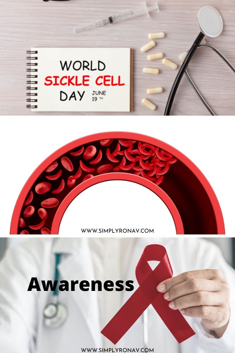 What is Sickle Cell Disease and How to Support the Cause - Simply Rona V.